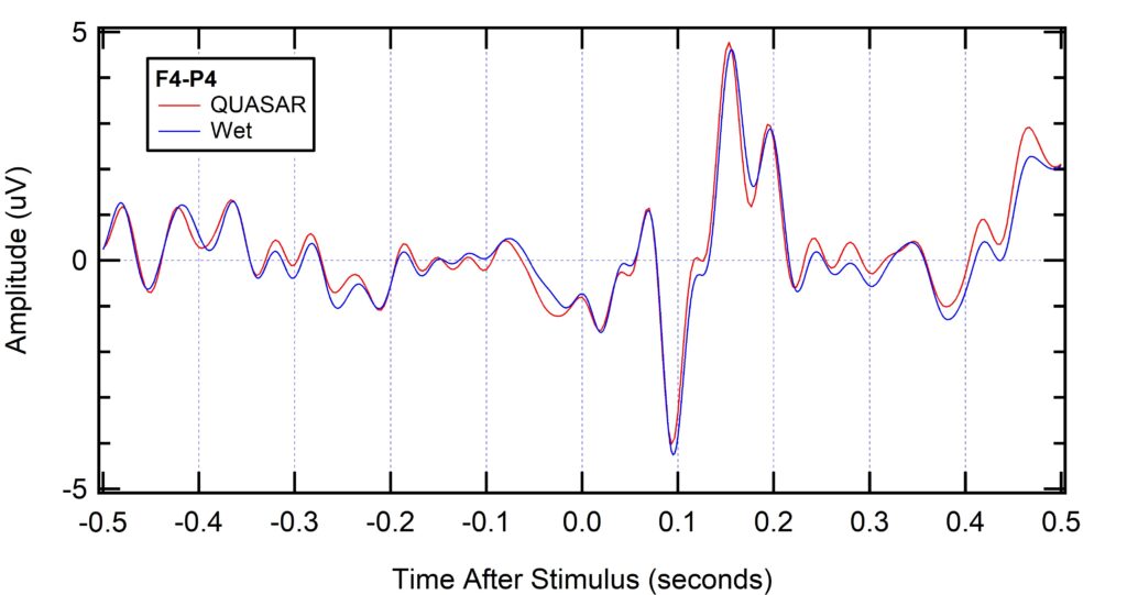 QUASAR – Sensing a World of Potential®